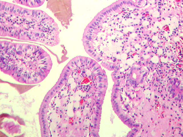 microscopic gallbladder